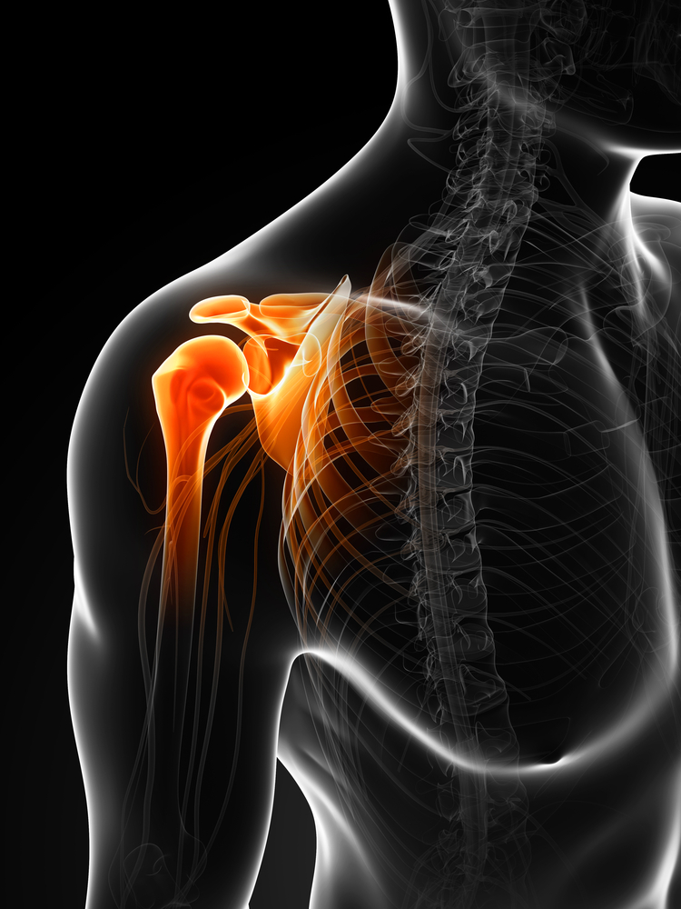Frozen Shoulder – What, Where, Why and How To Get Relief - Chiropractic ...